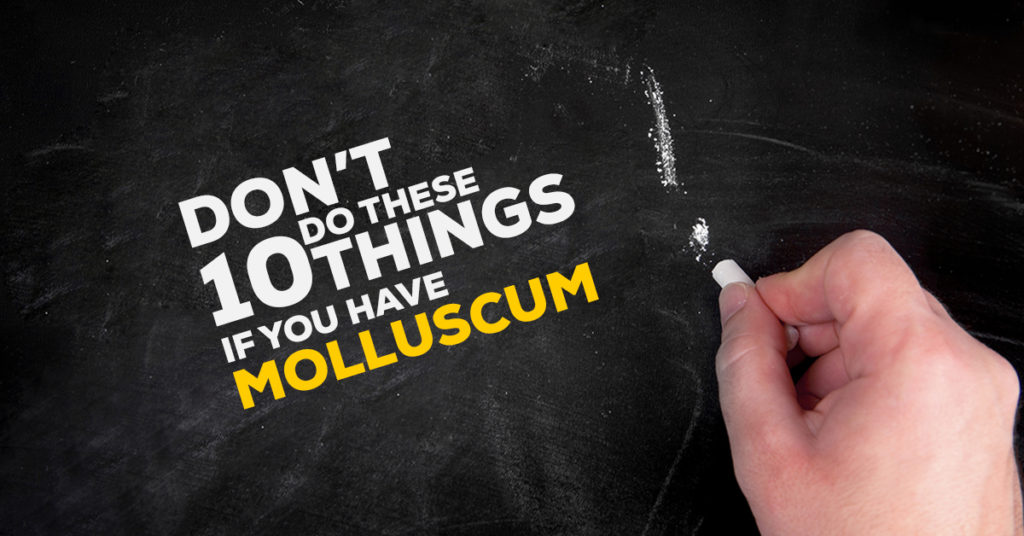 Don’t Do These 10 Things If You Have Molluscum Contagiosum - Conzerol